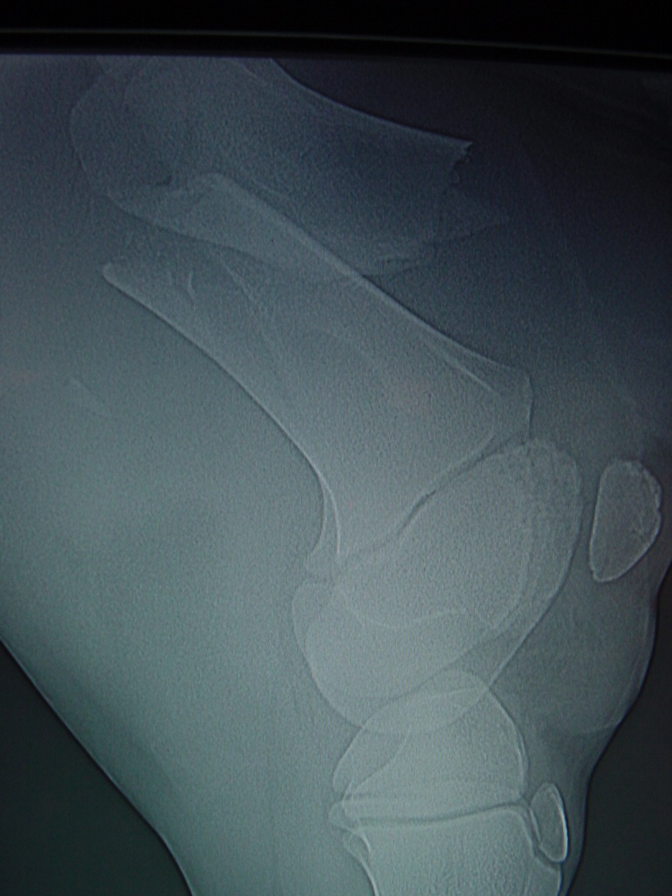 Fractures – Chirurgie – EquiTom Equine Clinic